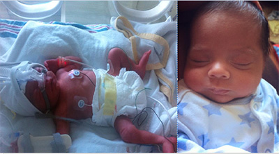 One tiny fighter: The birth of Arthur - Pregnancy & Newborn Magazine